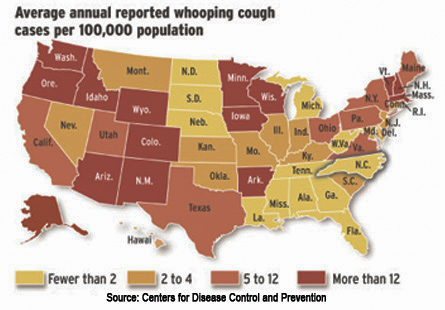Whooping Cough Case in KCSD – The Record Online